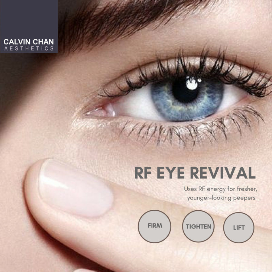 RF Eye Revival - CALVIN CHAN AESTHETICS